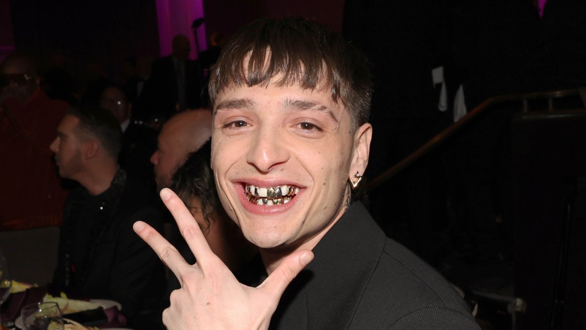 Fotos: los dientes de Peso Pluma antes de los Grammy 2024 – Telemundo ...